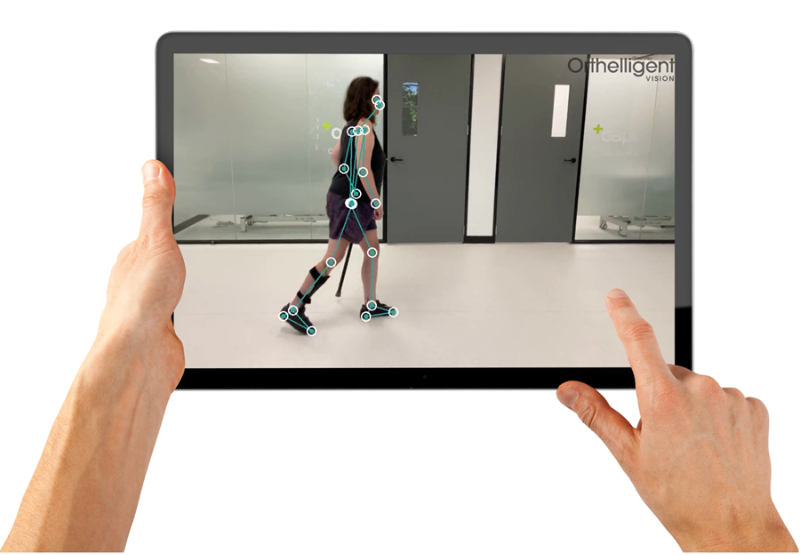 Orthelligent® VISION: Revolutionizing Gait Analysis with AI Technology ...