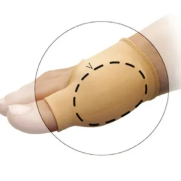 Arch Supports & Bunions | OPC Health