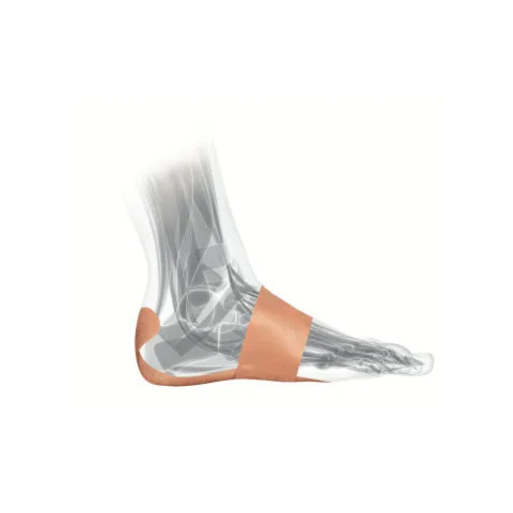 Mueller PF Fasciaderm Tape | OPC Health