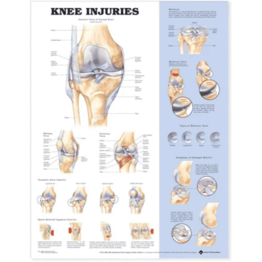 Knee Injuries Chart | OPC Health